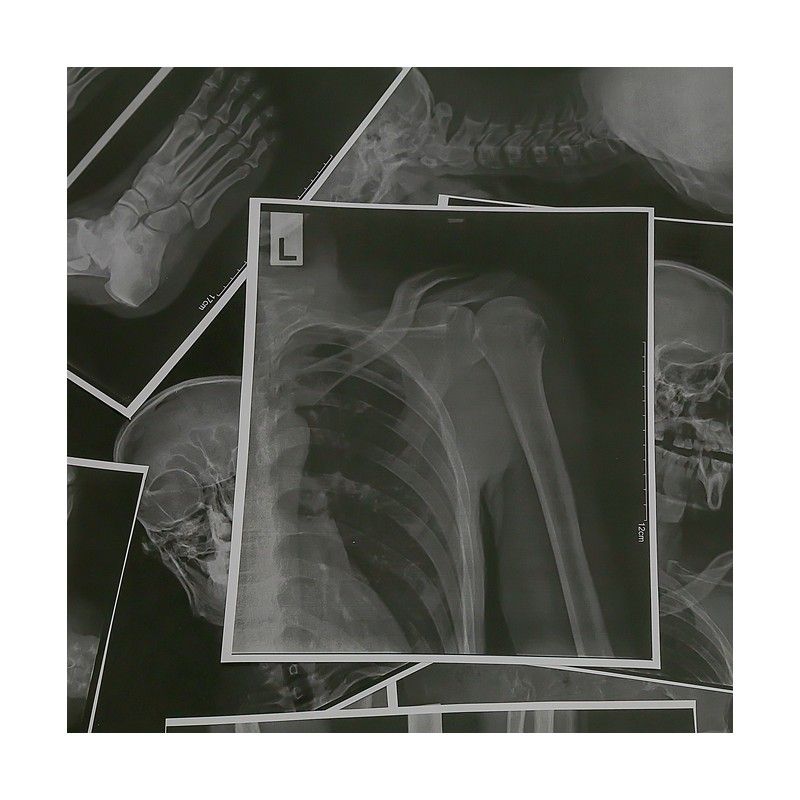 RX GRUPO A (Columna, Húmero, Fémur, Abdomen y Tórax) en Madrid