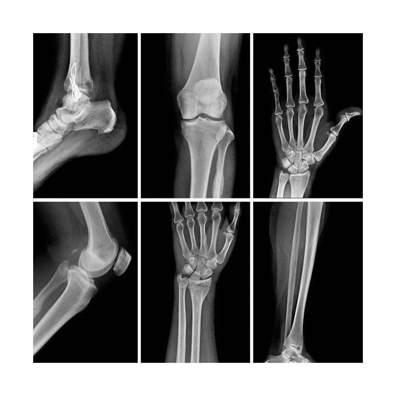 RX GRUPO B (Hombro, Codo, Muñeca, Cadera, Rodilla, Tobillo, Clavícula ...